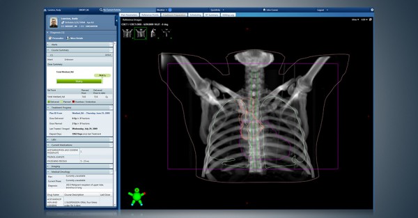 ARIA Oncology EMR Software Free Demo, Pricing, Latest Reviews 2020 ...