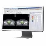 MOSAIQ EMR Software Free Demo, Pricing, Latest Reviews 2026 | EMRSystems